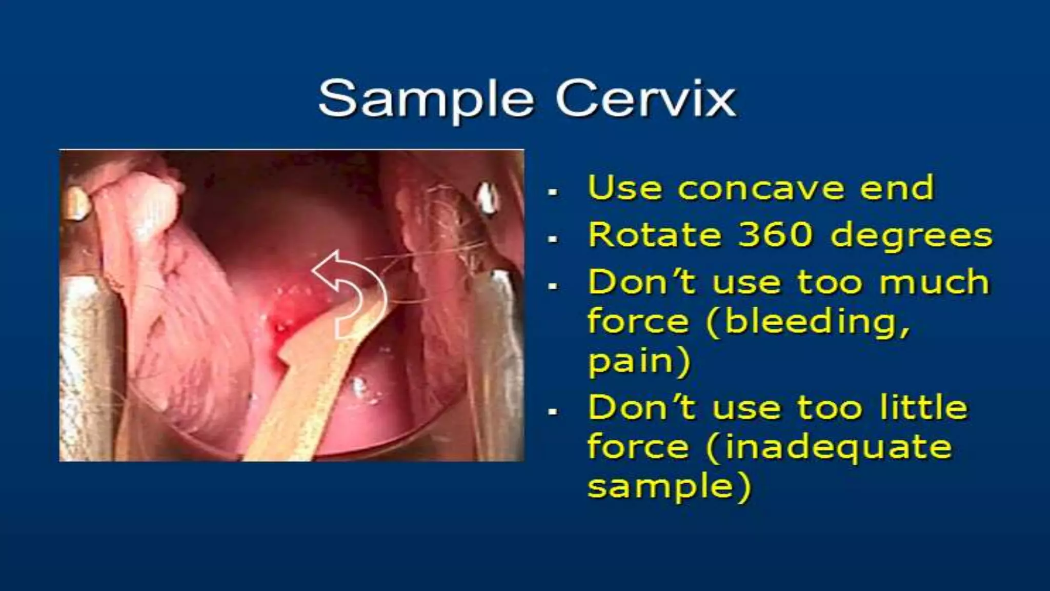 Cervical Screening Program | PPT