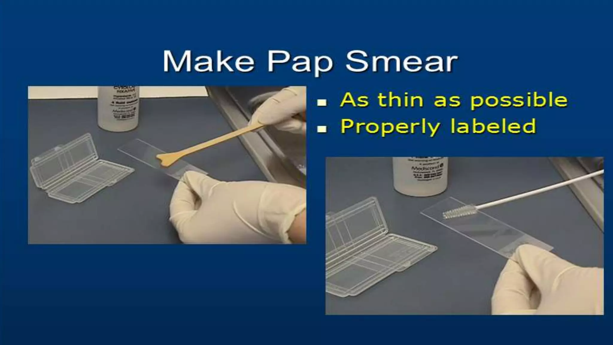 Cervical Screening Program | PPT