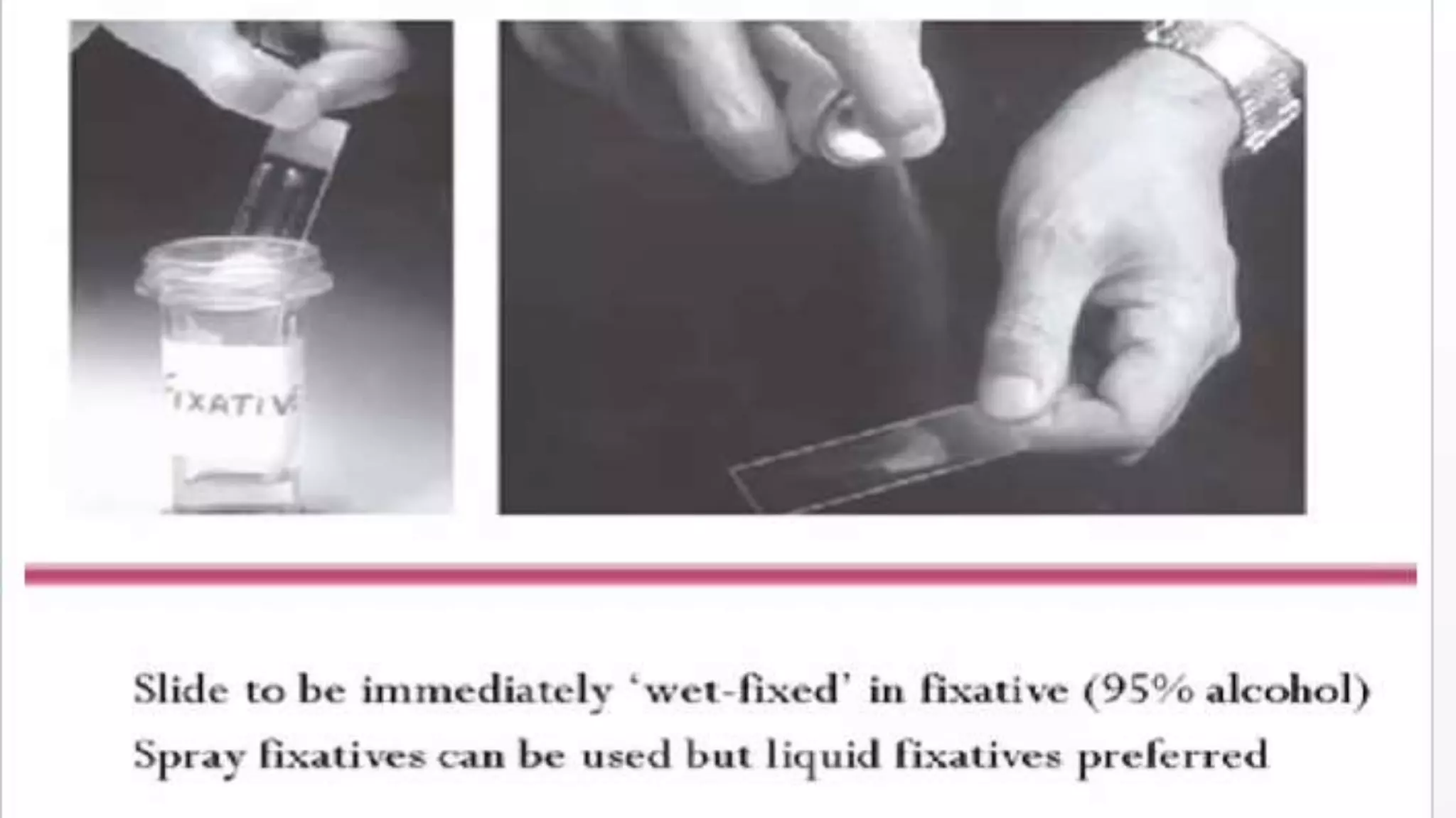 Cervical Screening Program | PPT