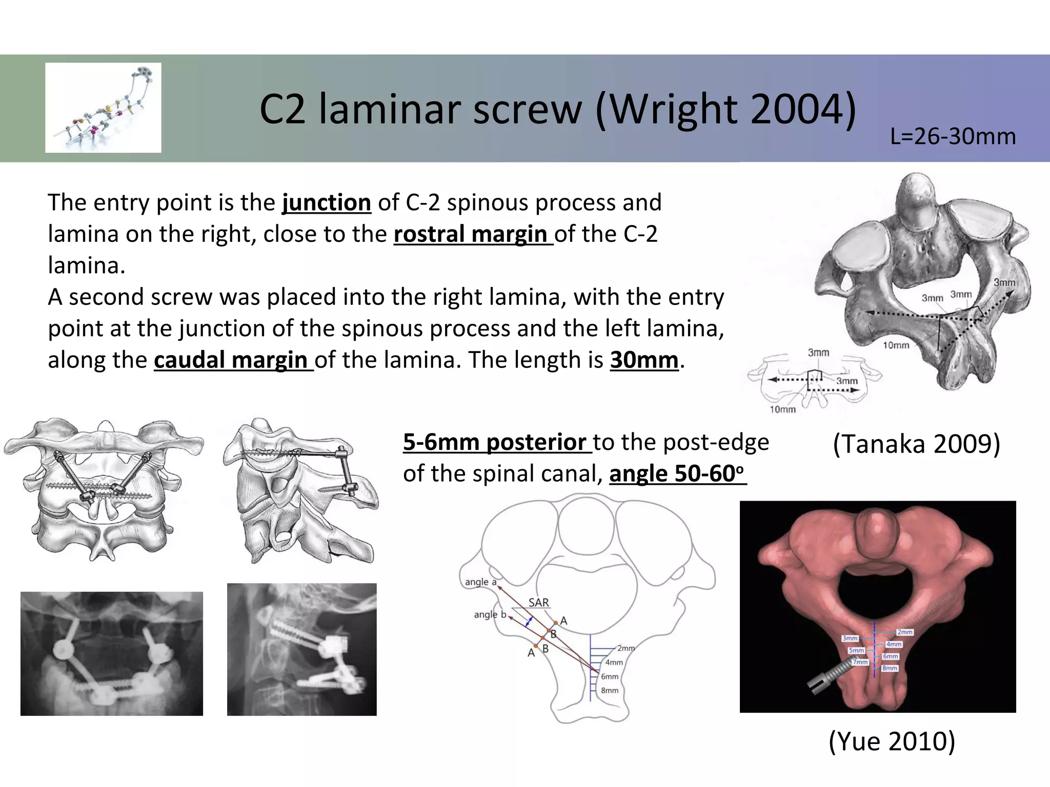 CervicalScrew2011 | PPT