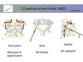CervicalScrew2011 | PPT
