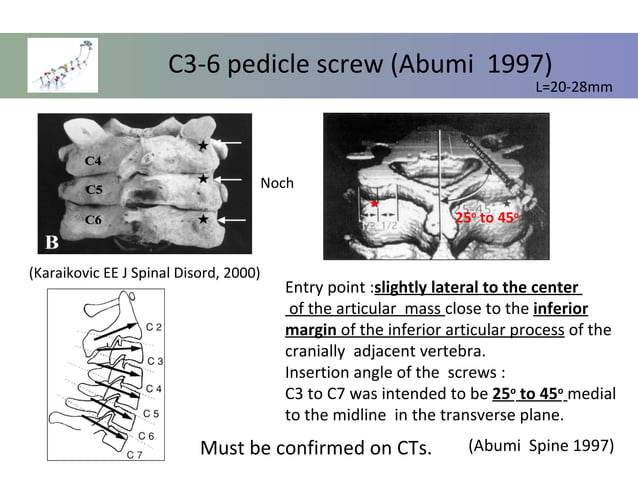 CervicalScrew2011 | PPT
