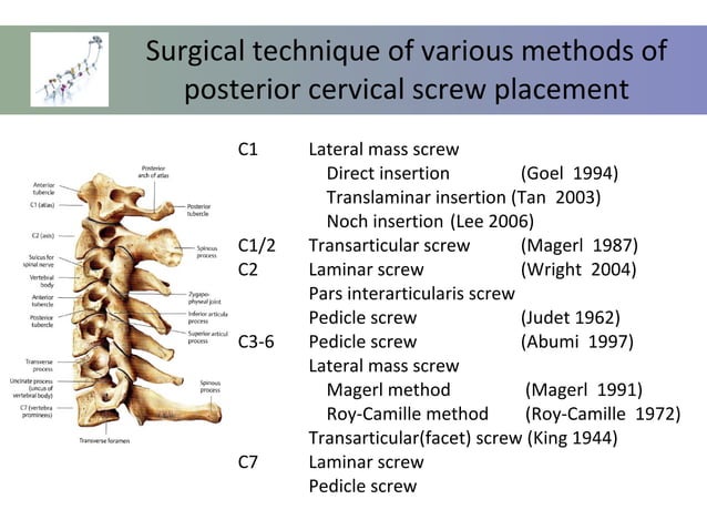 CervicalScrew2011 | PPT