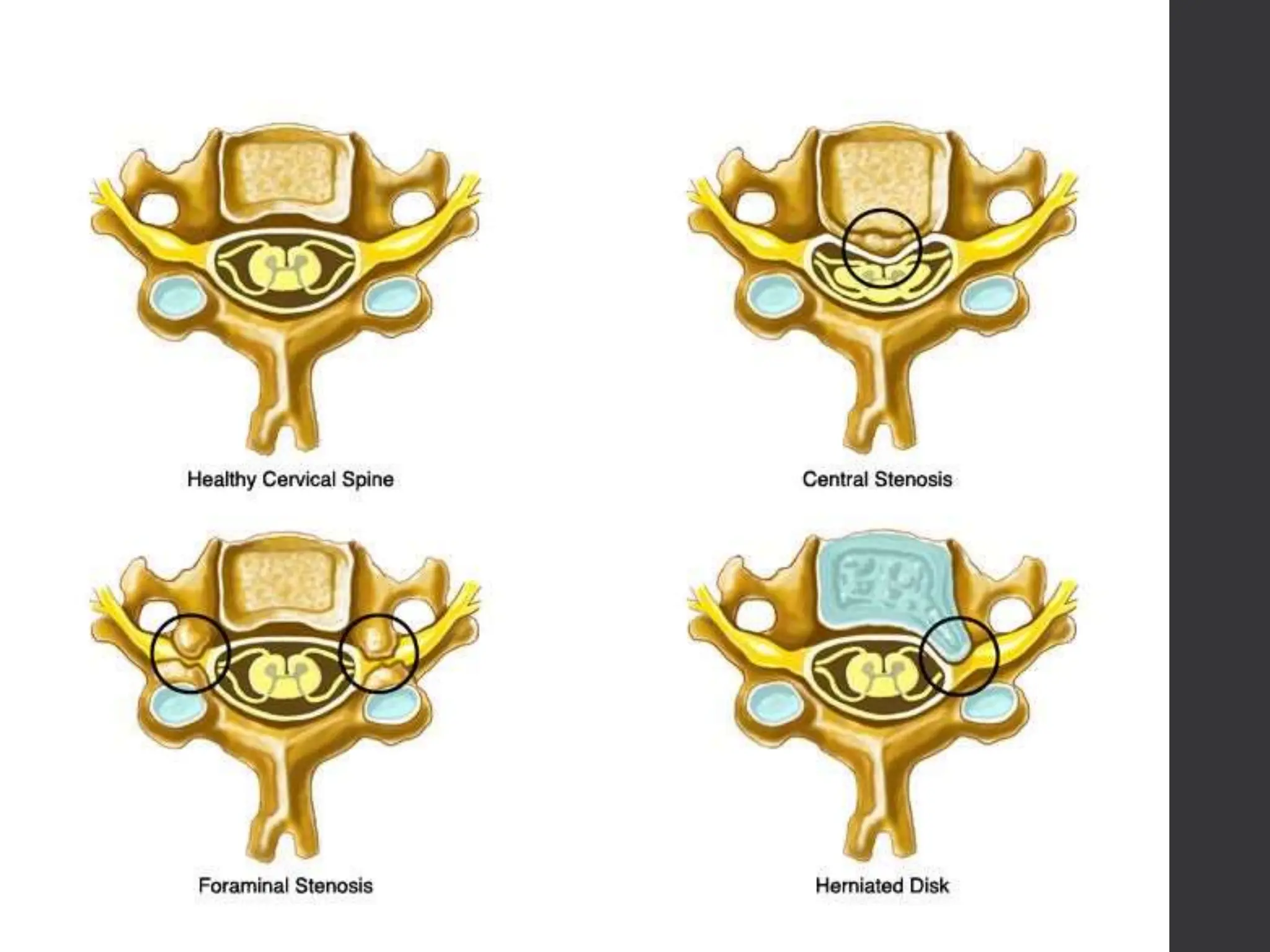 Cervical examination and special tests.pptx