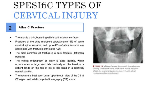 Cervical Spinal Cord Injury j- Yudi.pptx
