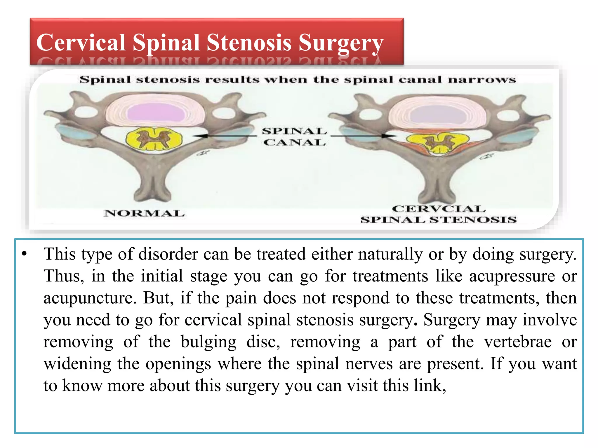 Cervical spinal stenosis | PPTX