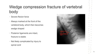 Cervical spine | PPT
