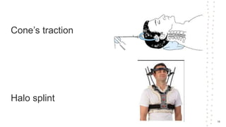 Cervical spine | PPT