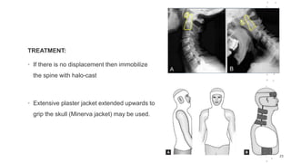 Cervical spine | PPT