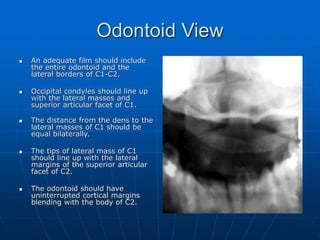 Imaging of the Cervical Spine Injuries.ppt