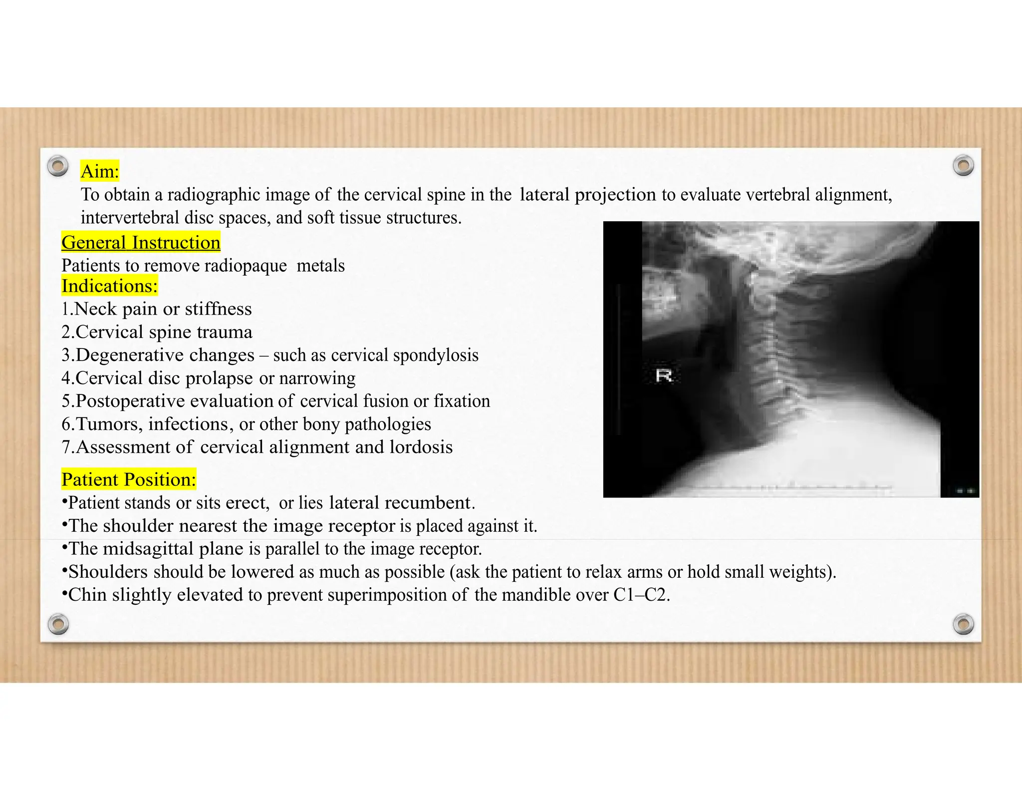 cervical spine.docx Cervical Spine Imaging Techniques | DOCX