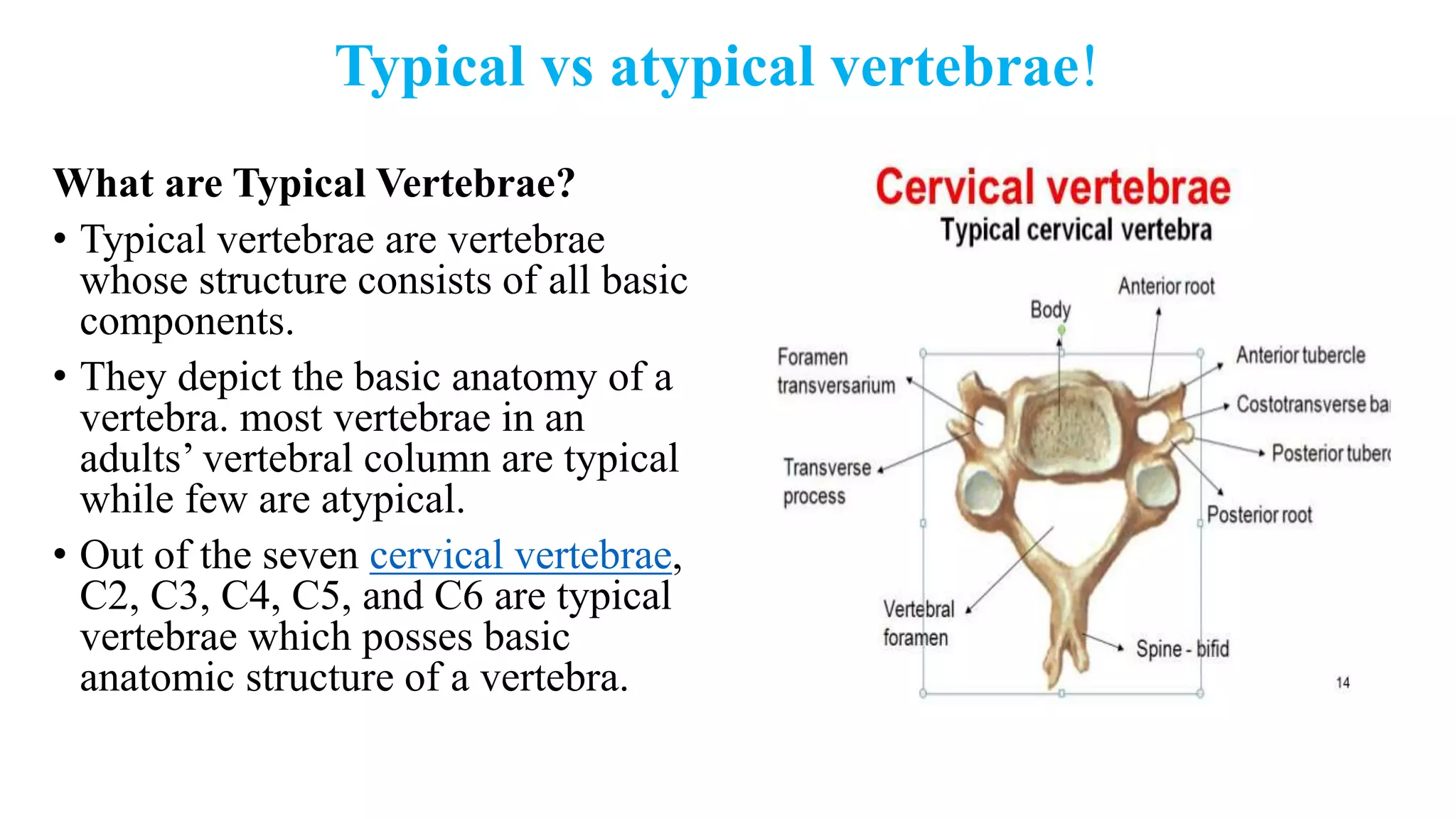 Typical Vertebrae And Atypical Vertebrae