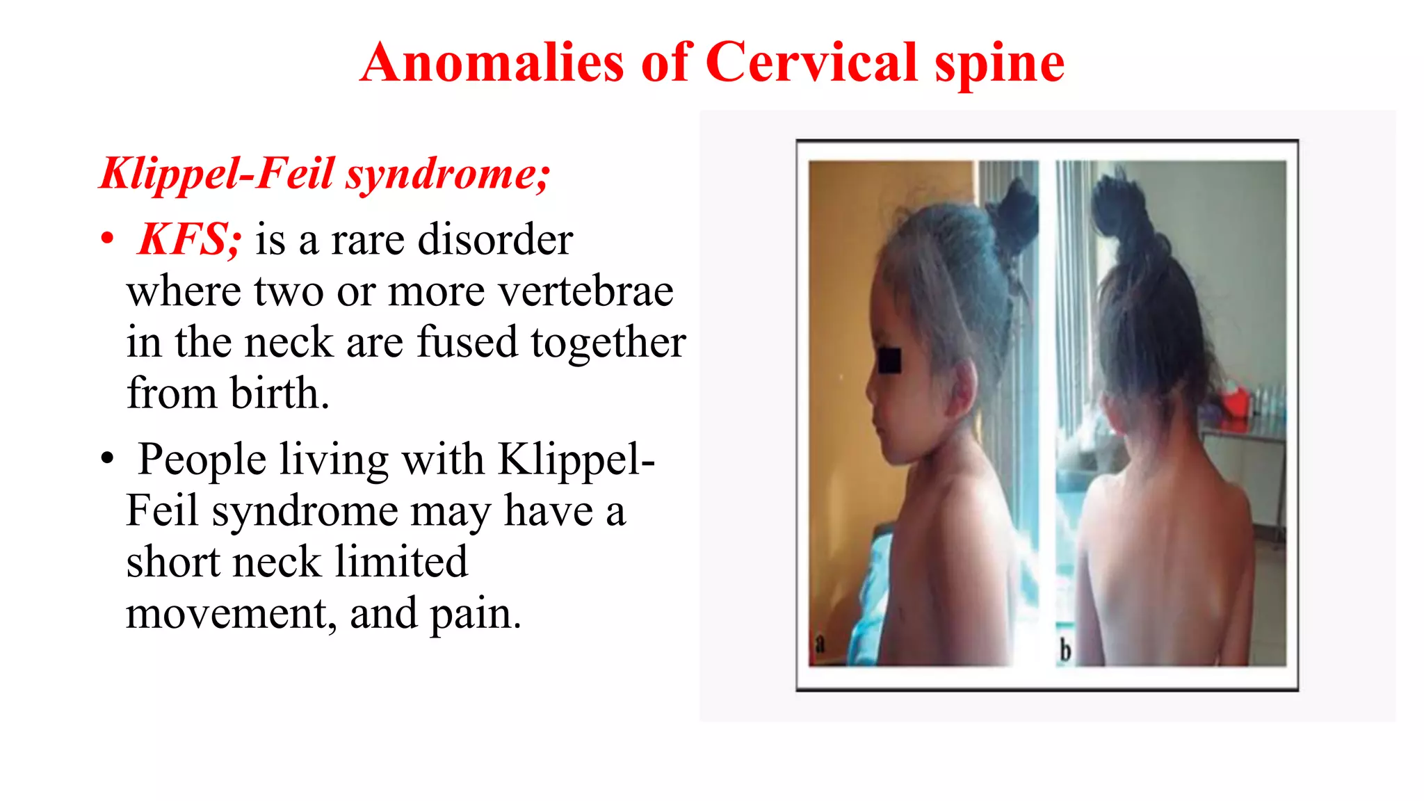 Cervical spine anatomy.pptx