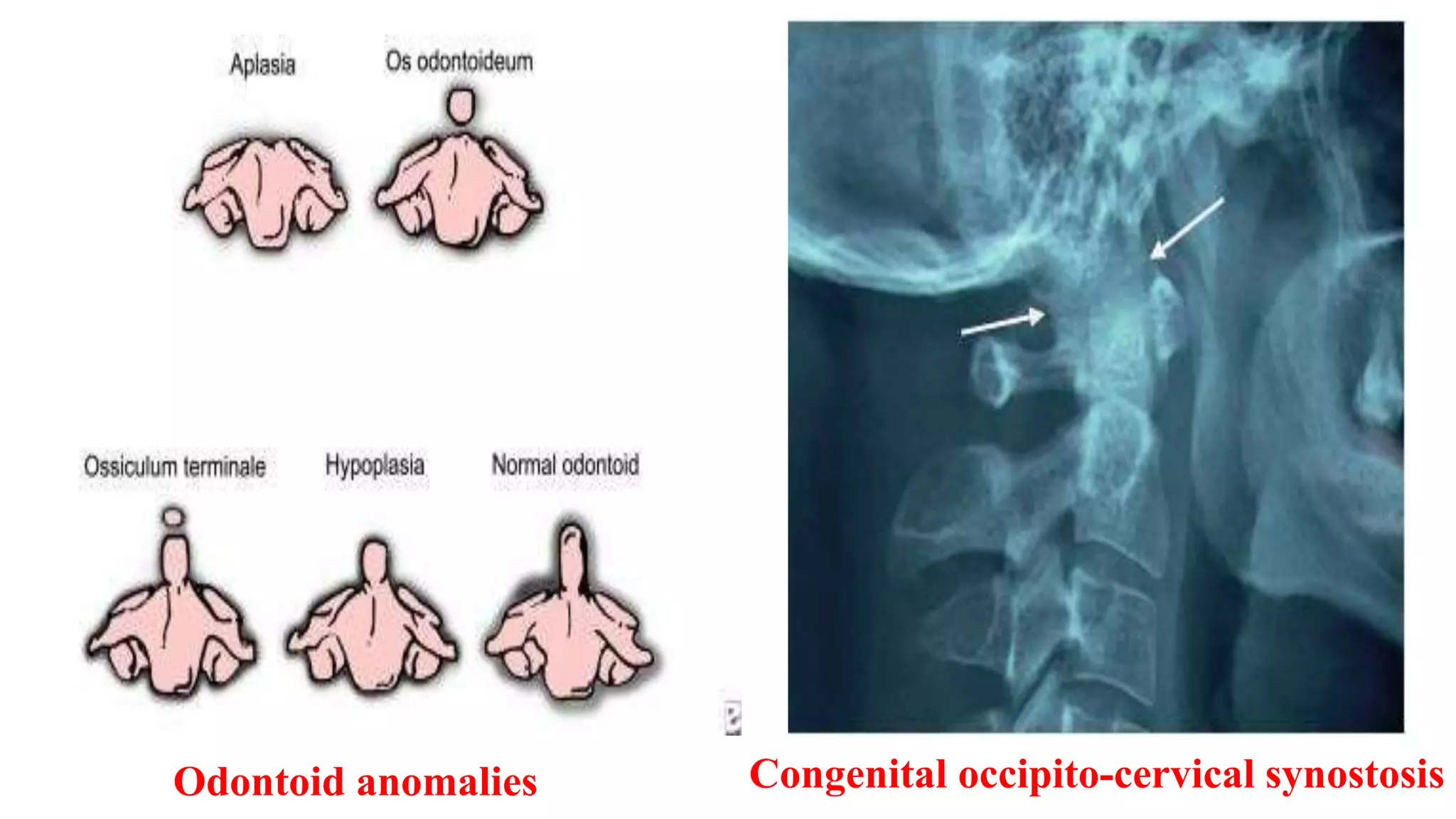 Cervical spine anatomy.pptx