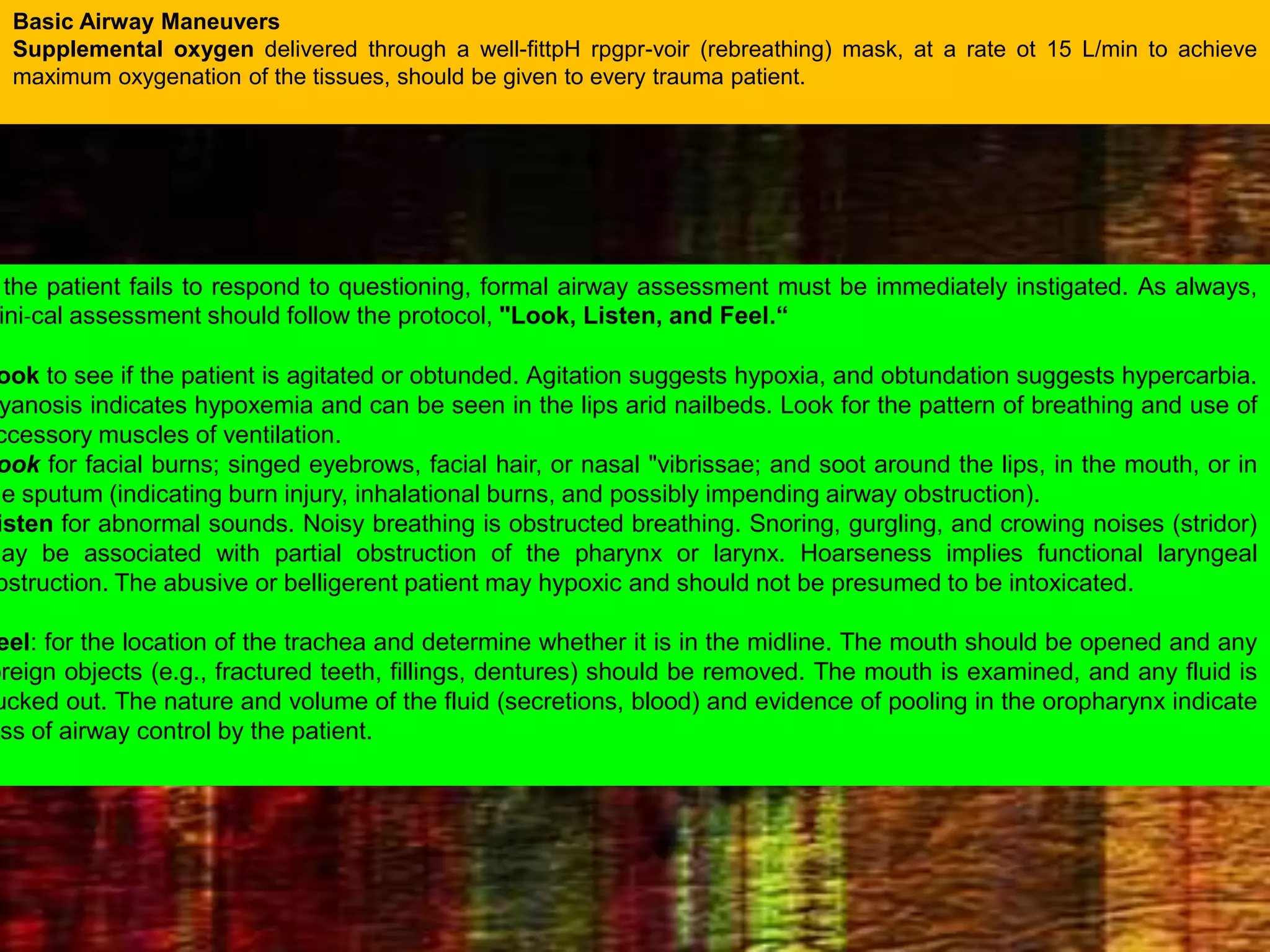 Cervical spine and airway in trauma | PPTX