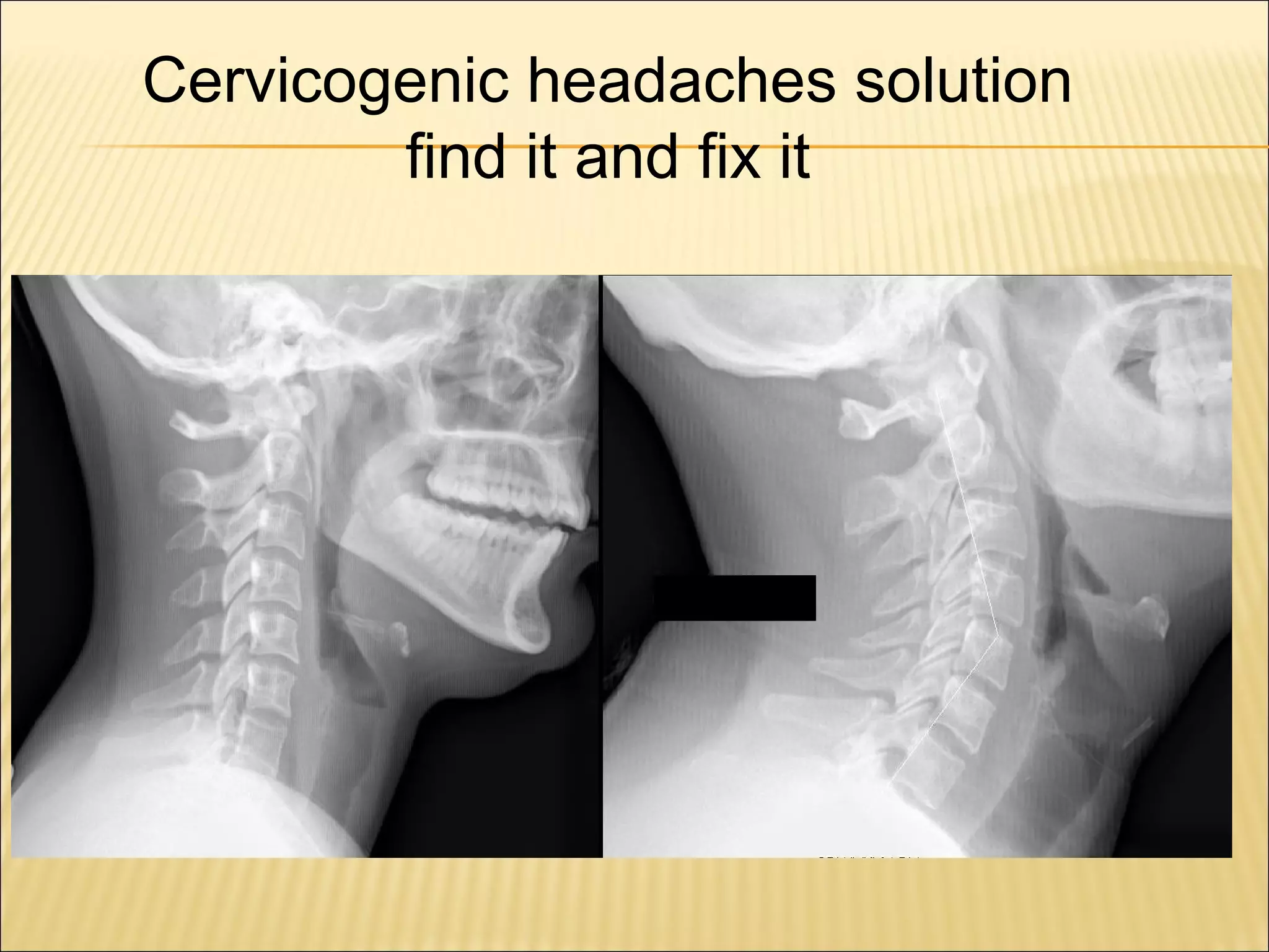 Cervical spine and shoulder problems | PPT