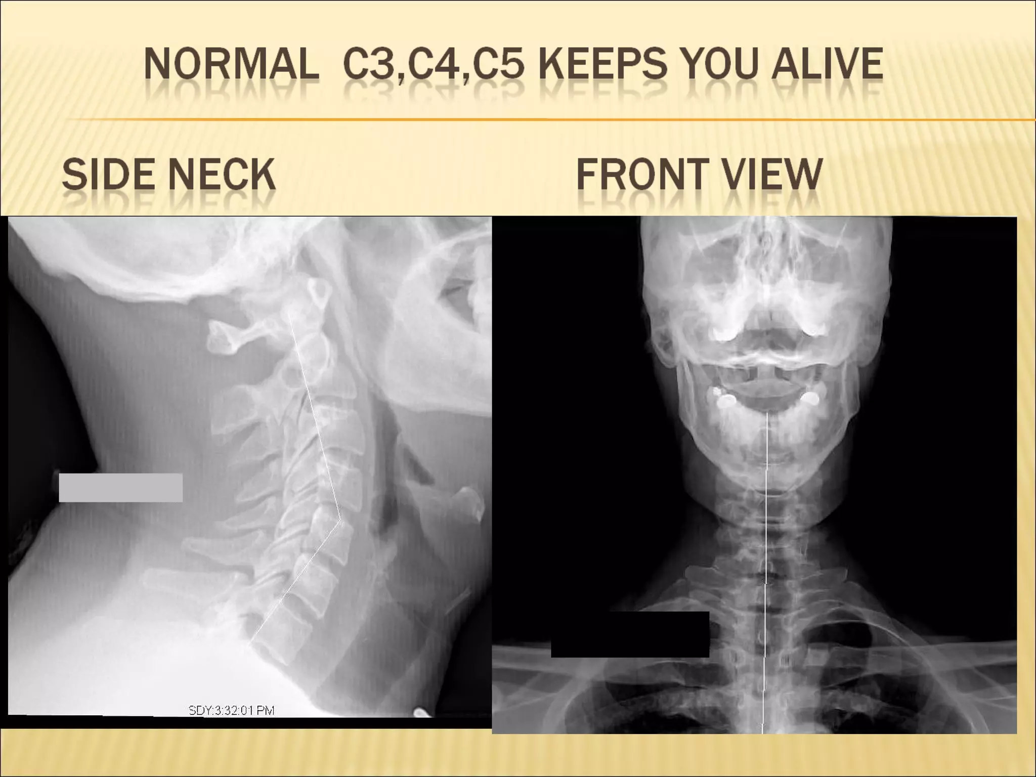 Cervical spine and shoulder problems | PPT