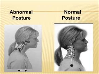 Cervical spine and shoulder problems | PPT