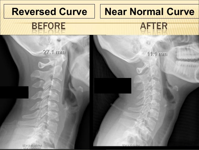 Cervical spine and shoulder problems