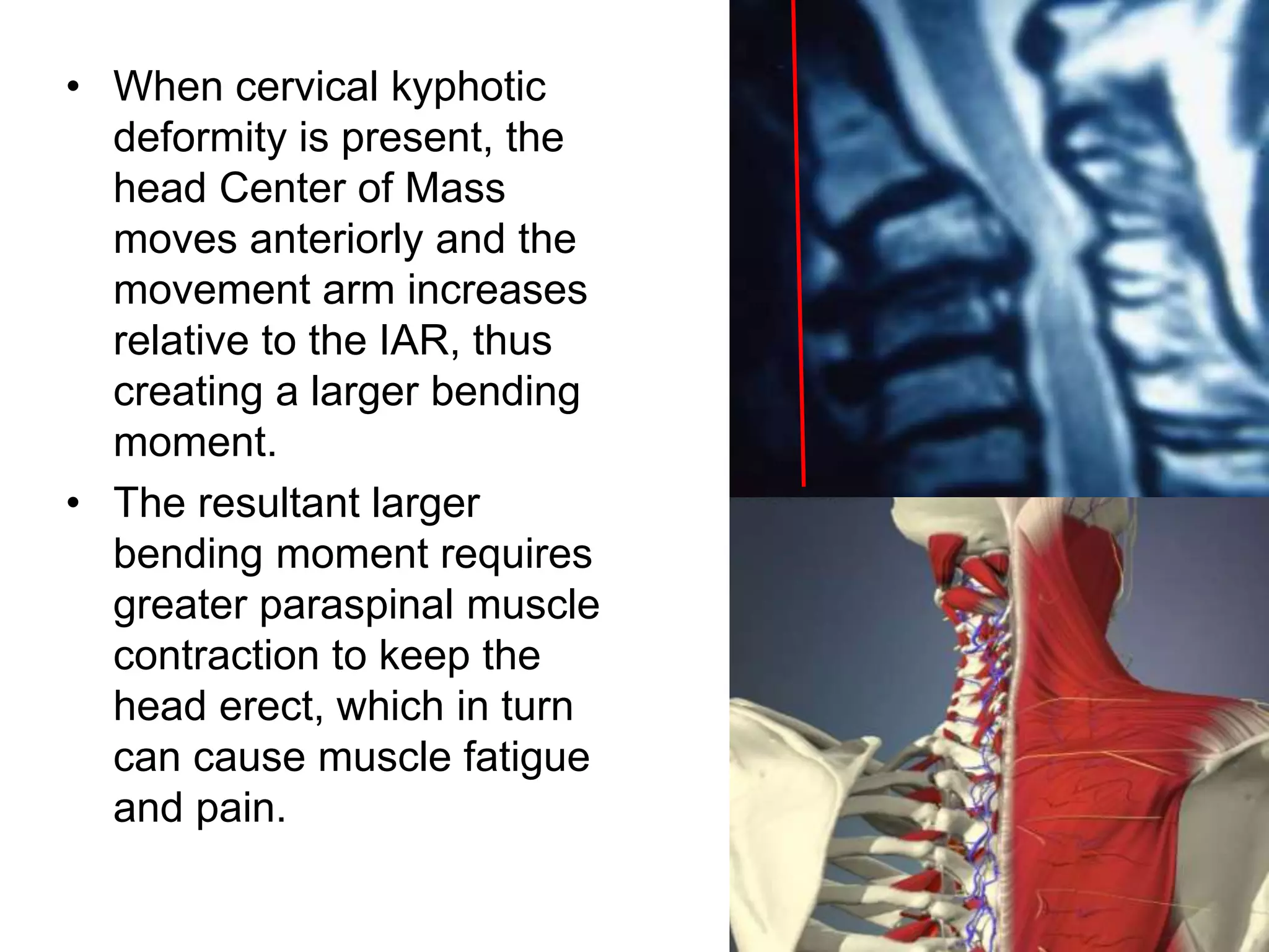 Cervical Spine Deformity 2019 | PPTX | Death, Injury, or Military ...