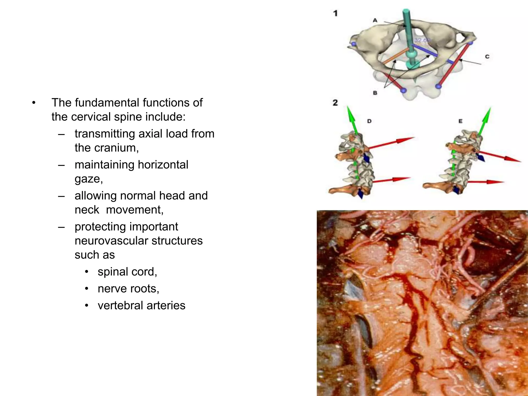 Cervical Spine Deformity 2019 | PPTX | Death, Injury, or Military ...