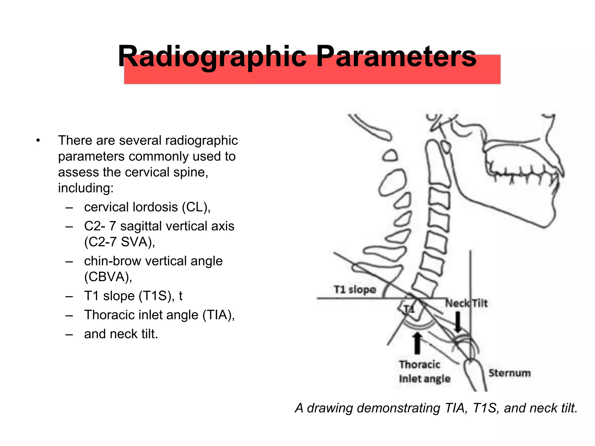 Cervical Spine Deformity 2019 | PPTX | Death, Injury, or Military ...