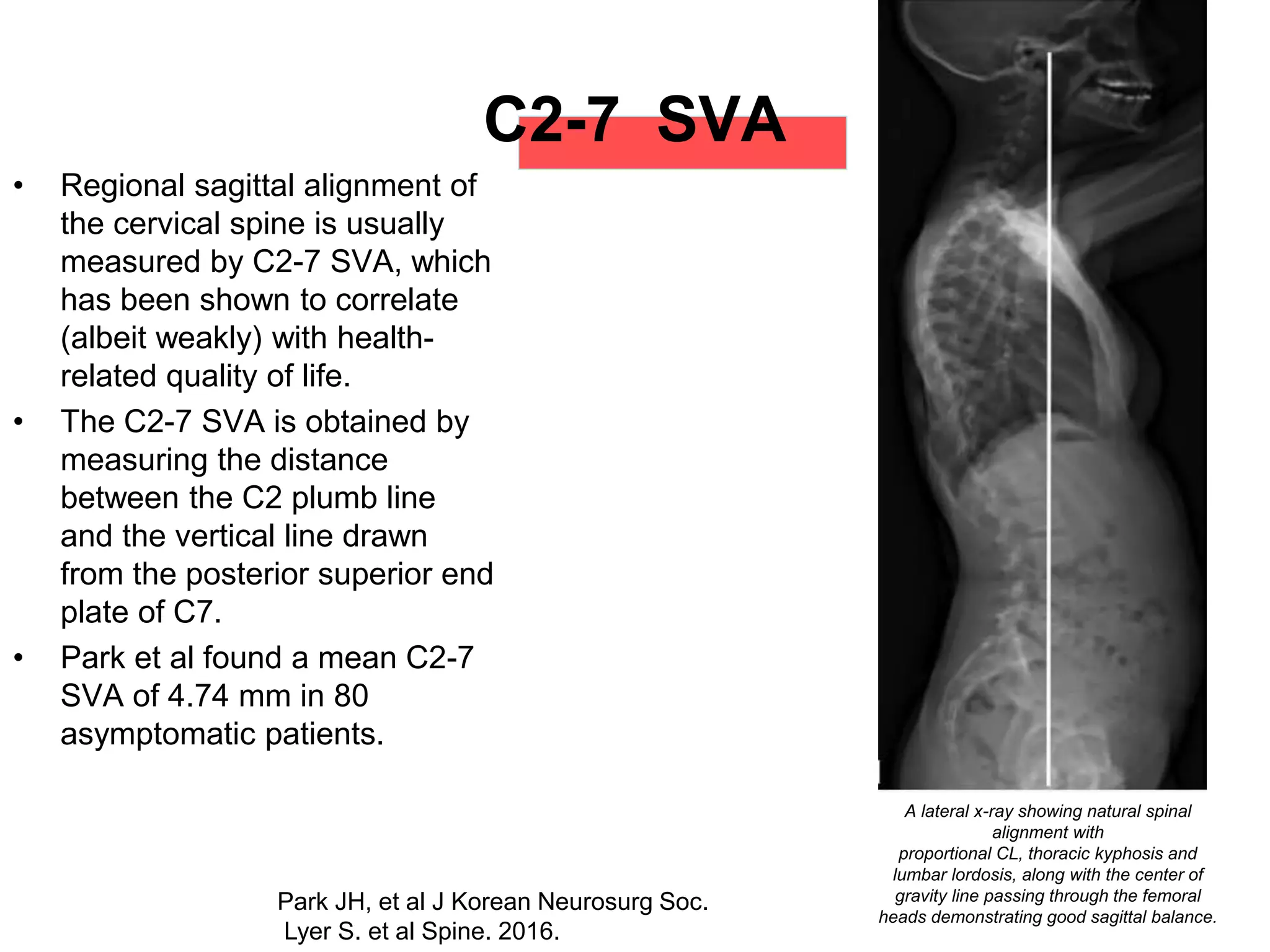 Cervical Spine Deformity 2019 | PPTX | Death, Injury, or Military ...