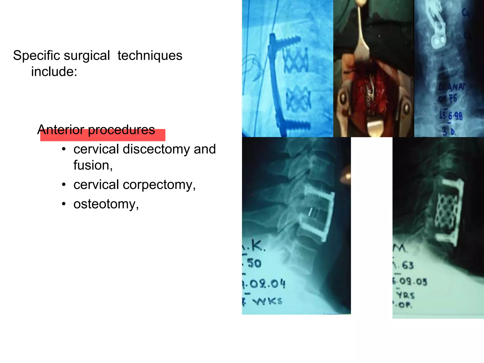 Cervical Spine Deformity 2019 | PPTX