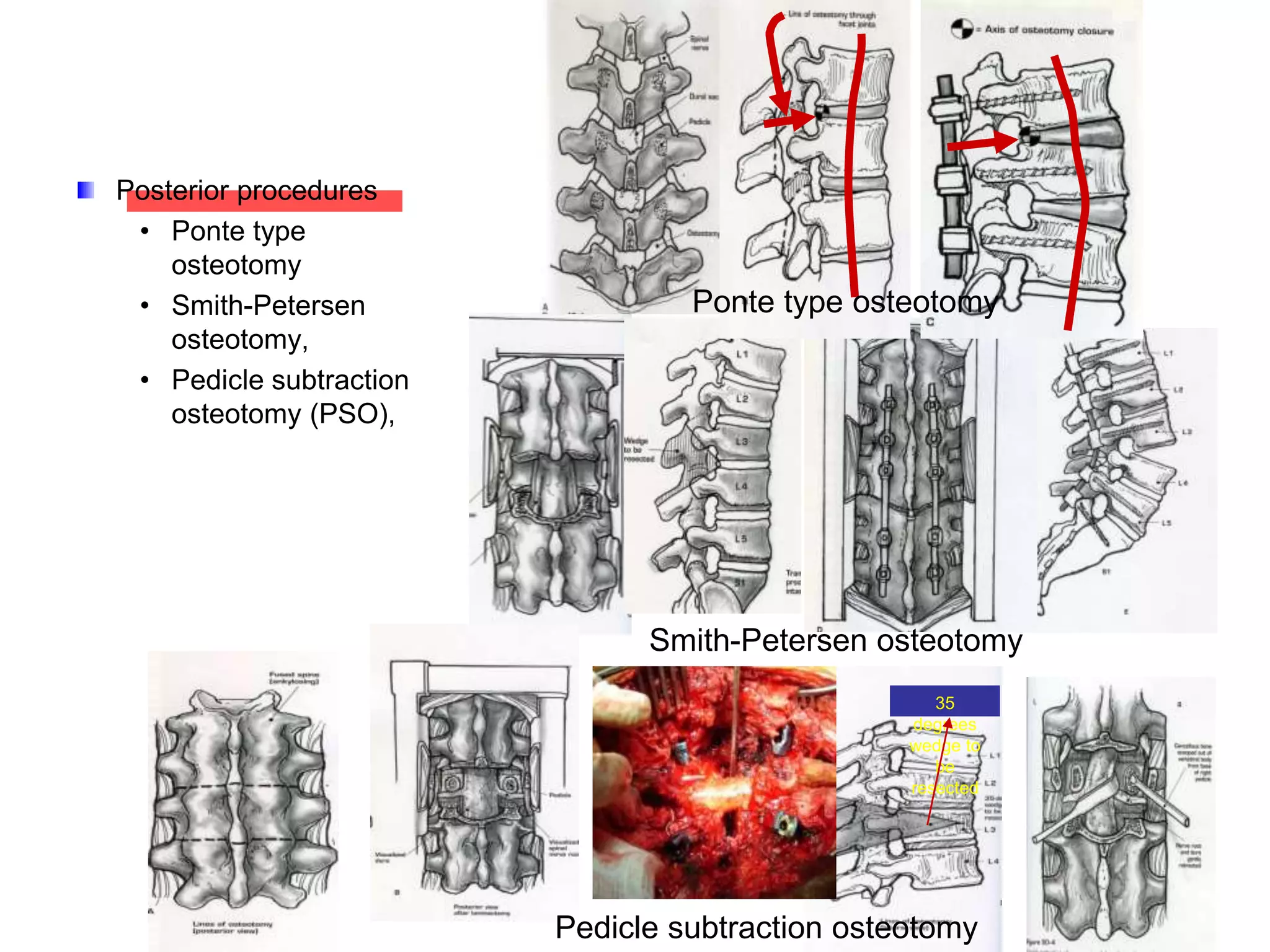 Cervical Spine Deformity 2019 | PPTX