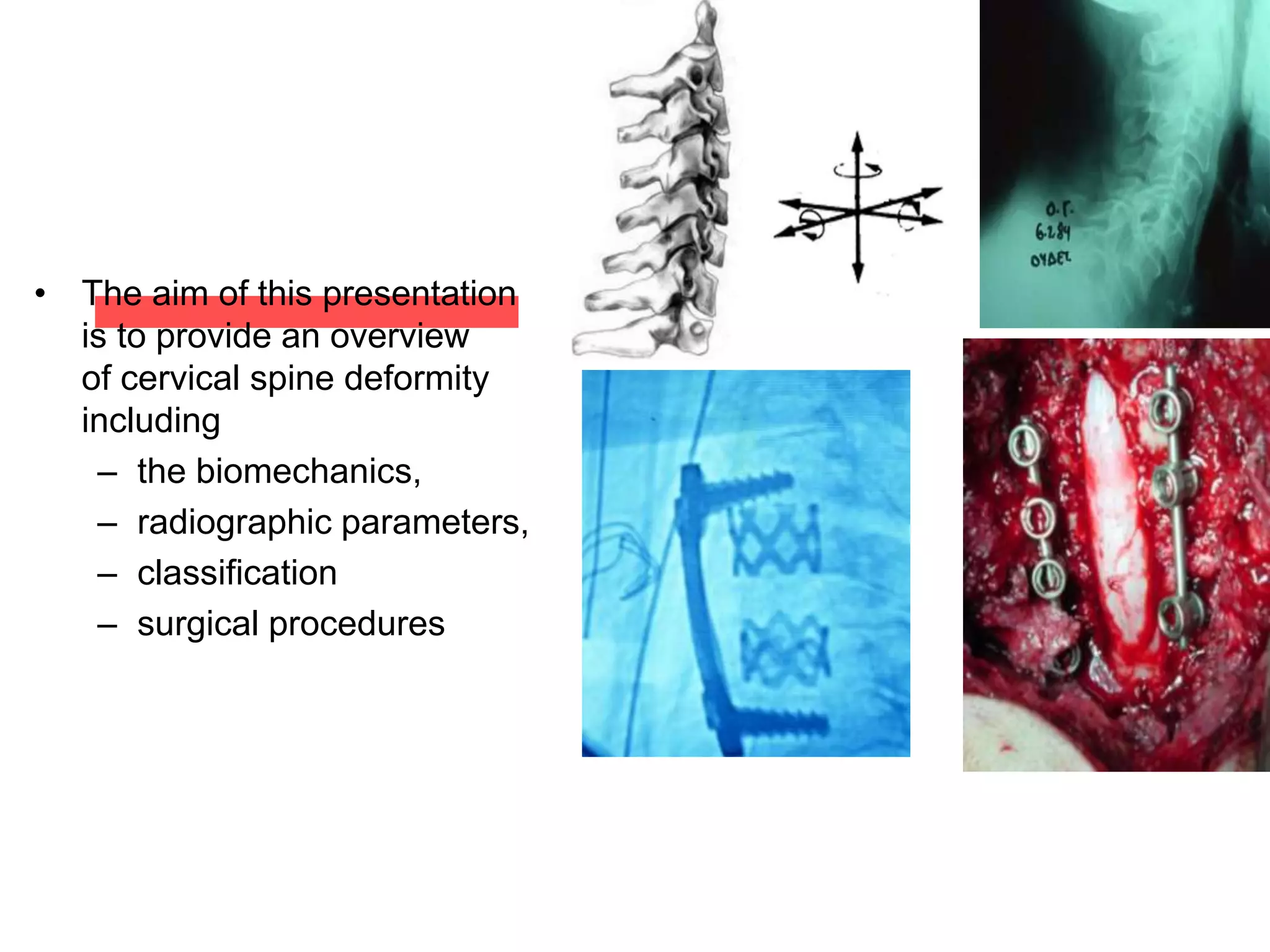 Cervical Spine Deformity 2019 | PPTX
