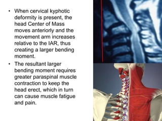Cervical Spine Deformity 2019 | PPTX