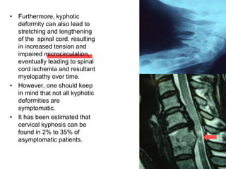 Cervical Spine Deformity 2019 | PPTX