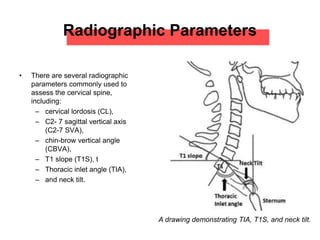 Cervical Spine Deformity 2019 | PPTX