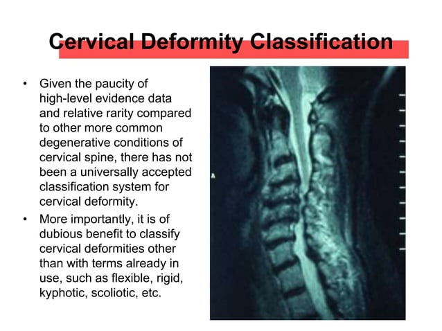 Cervical Spine Deformity 2019 | PPTX
