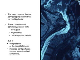 Cervical Spine Deformity 2019 | PPTX | Death, Injury, or Military ...