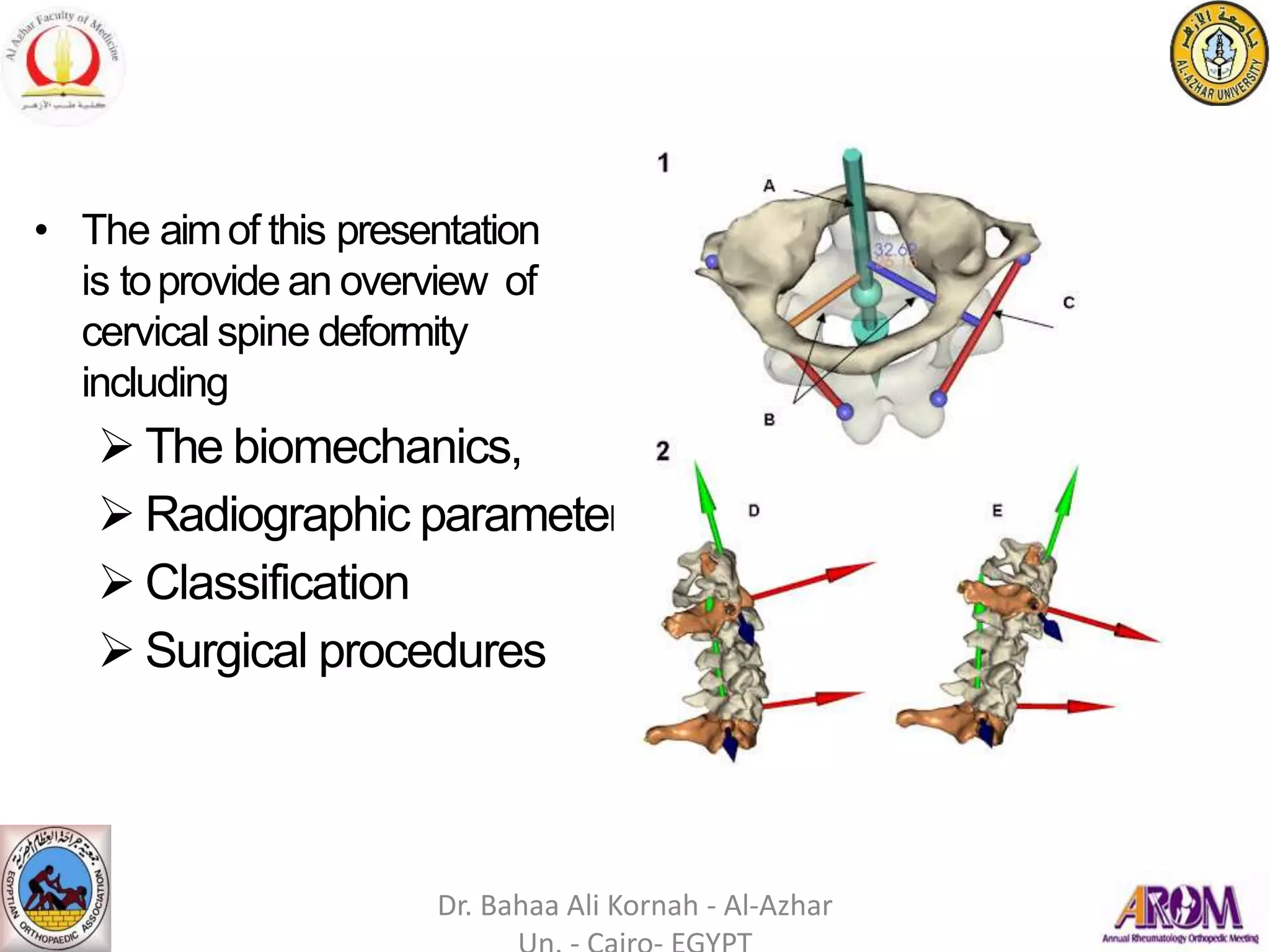 Cervical spine deformity bahaa | PPT