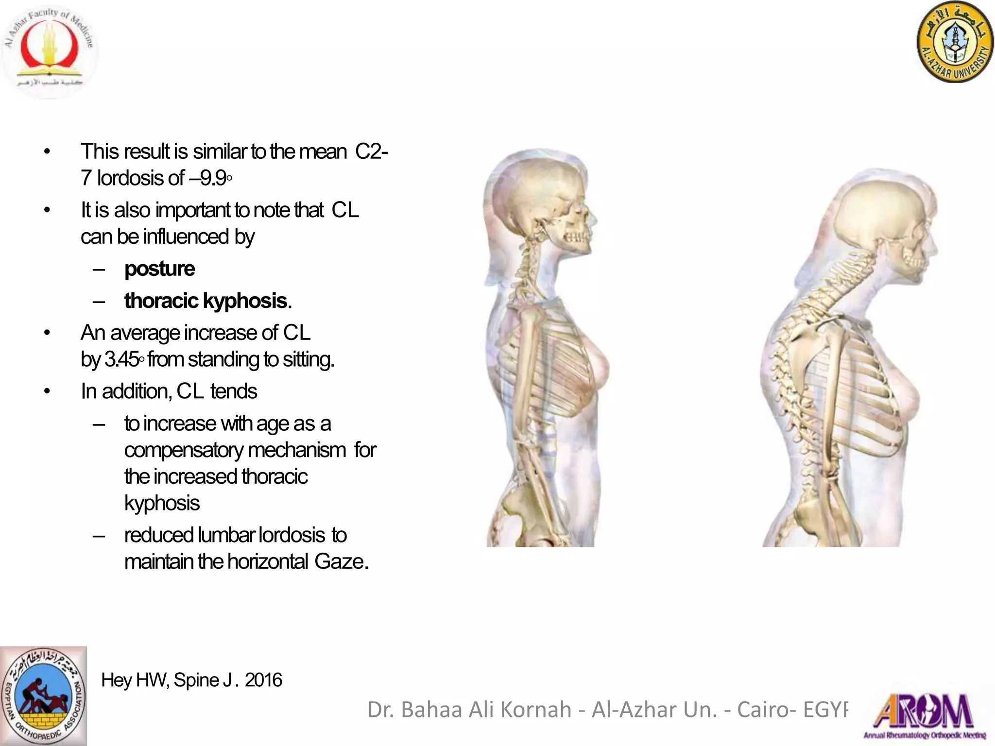 Cervical spine deformity bahaa | PPT