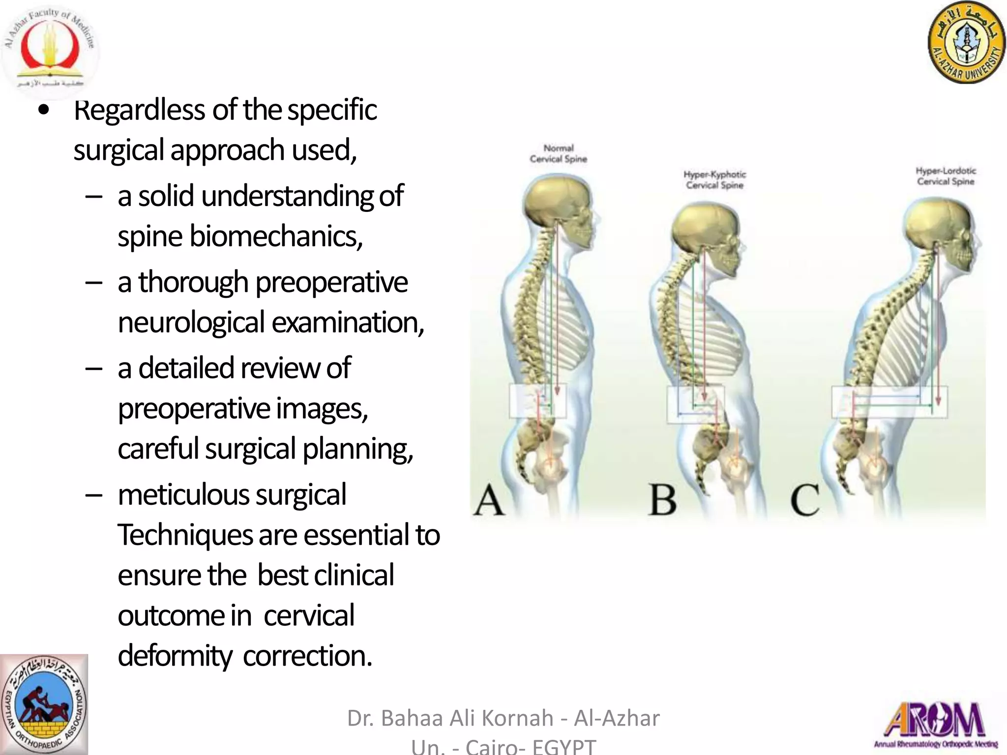 Cervical spine deformity bahaa | PPT