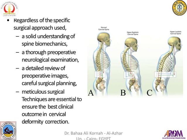 Cervical spine deformity bahaa | PPT
