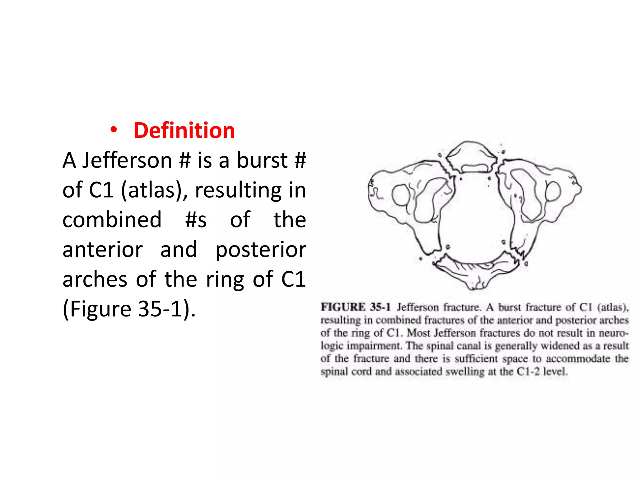 Cervical spine fractures dnbid 2020 | PPTX