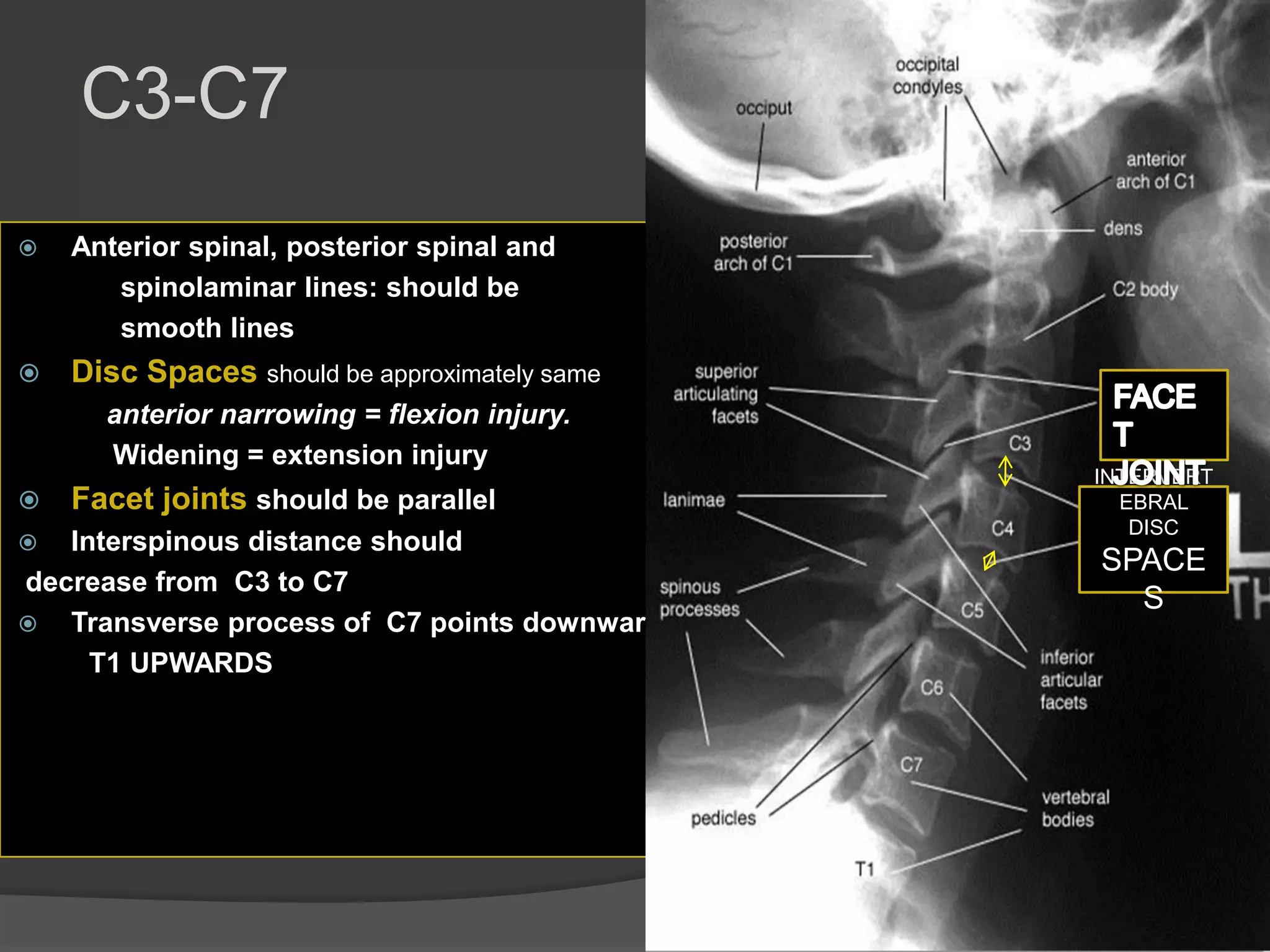 Cervical spine fractures muhamma | PPTX