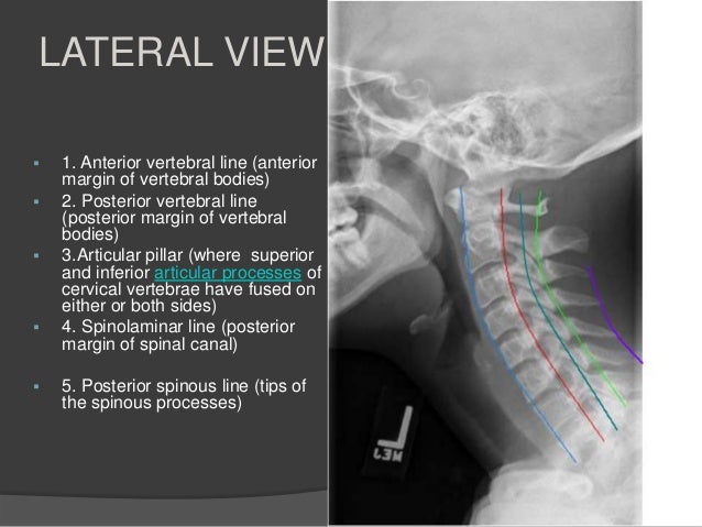 Cervical spine fractures muhamma