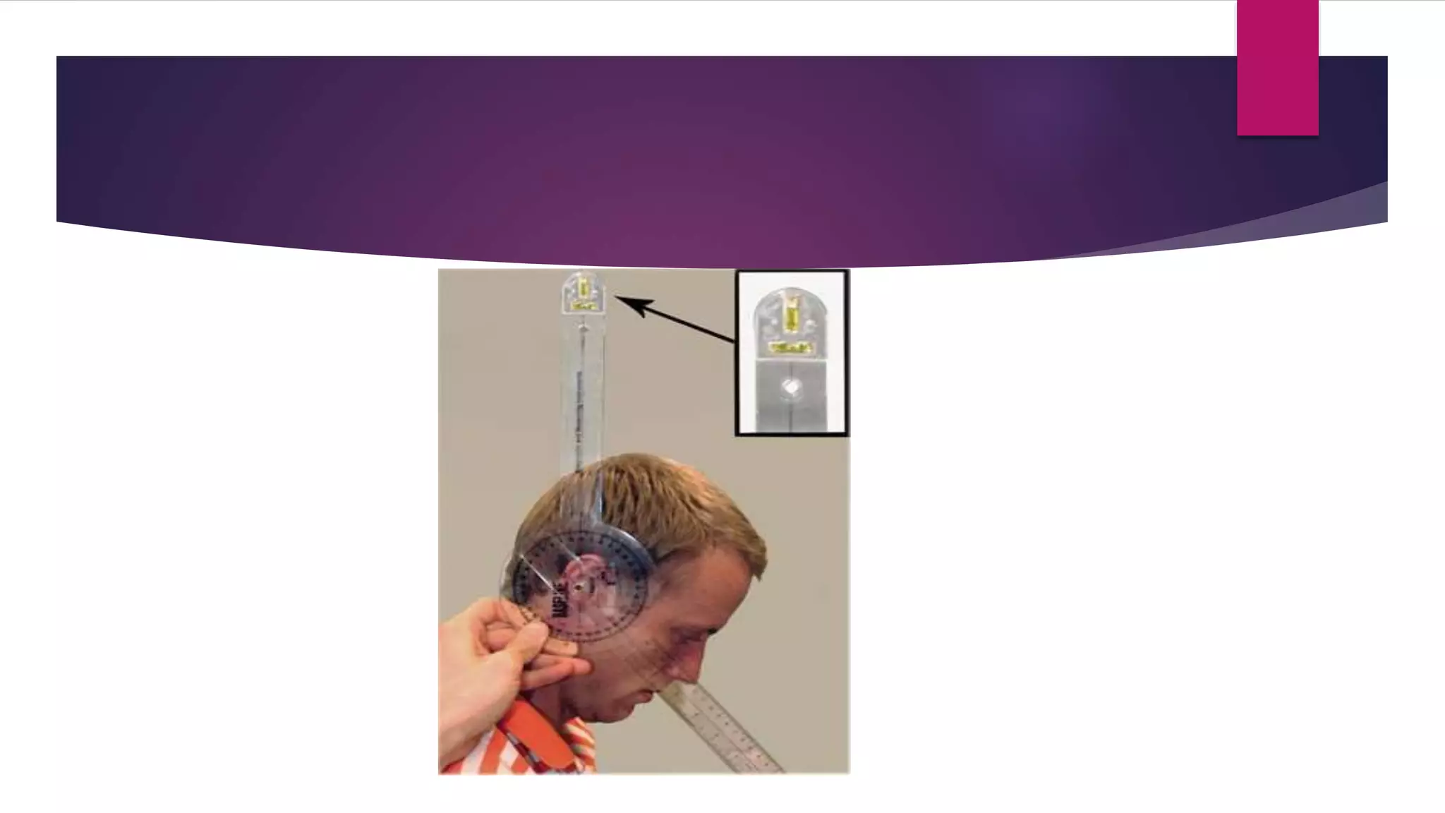 Cervical spine gonio | PPTX