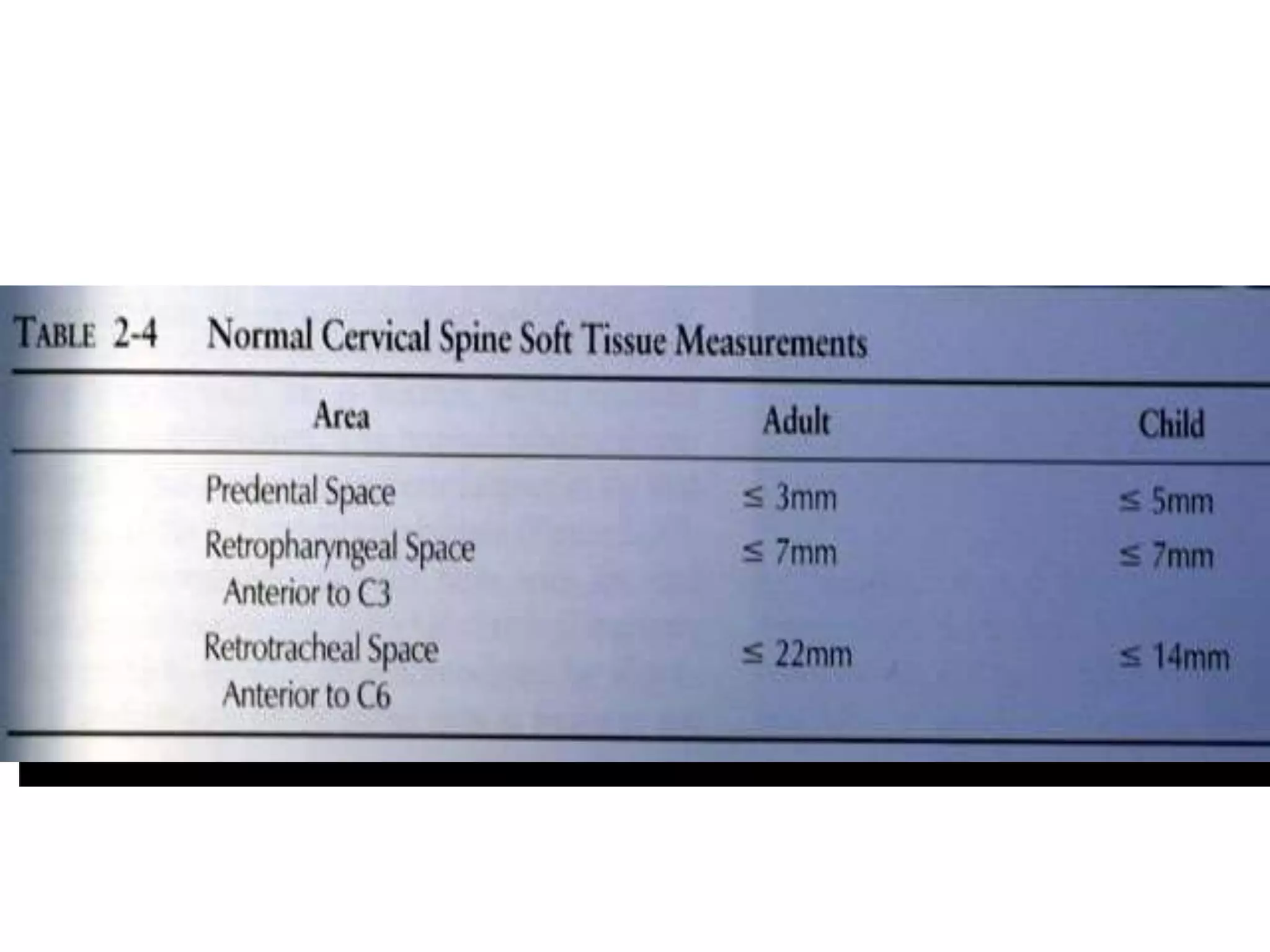 Cervical spine injuries and its management | PPTX