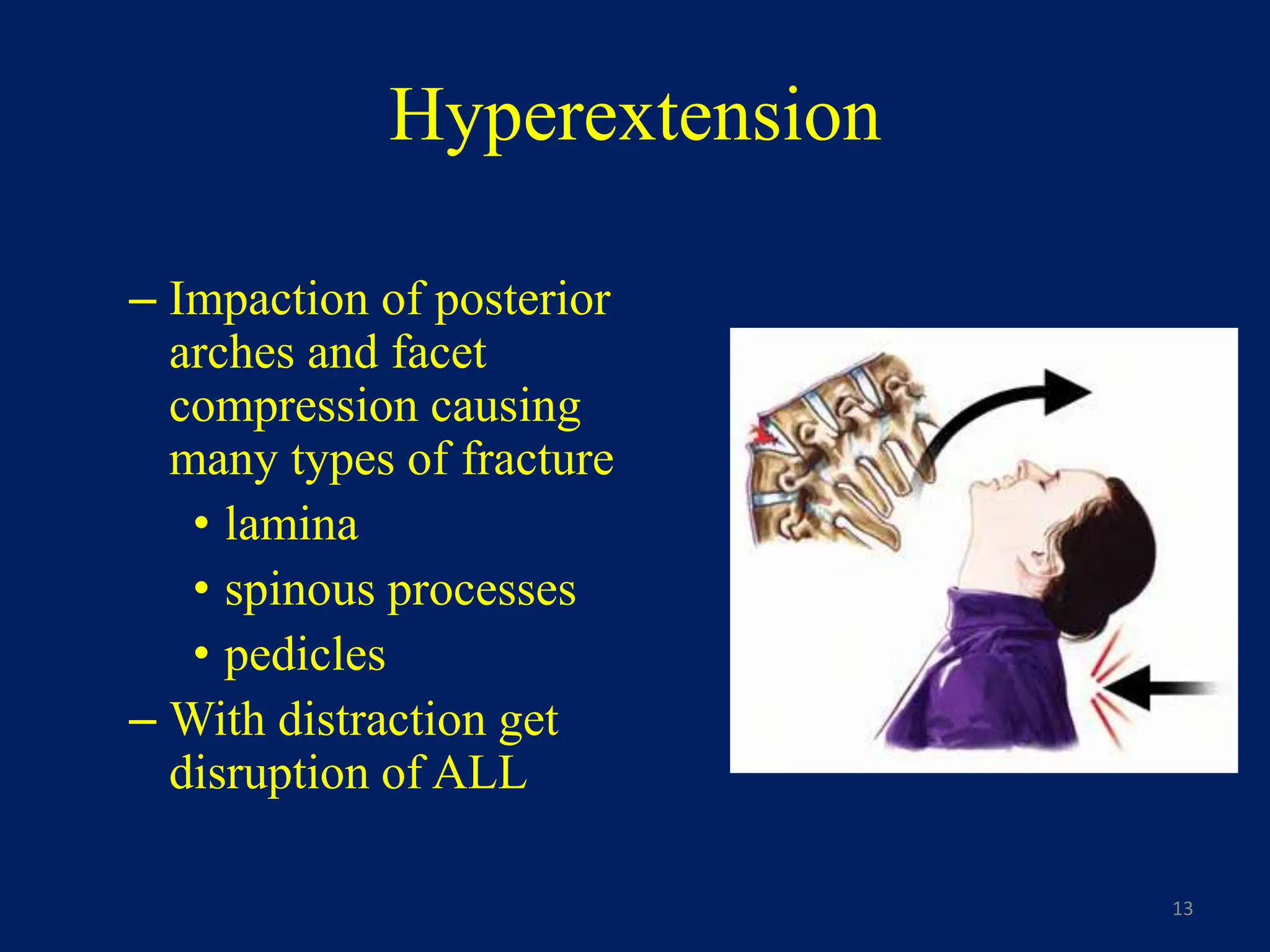 Cervical spine injury antomy and management.pptx