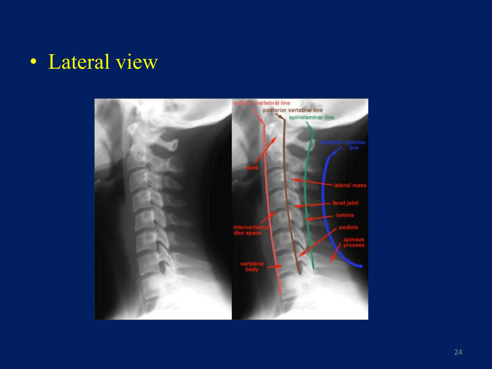 Cervical spine injury antomy and management.pptx