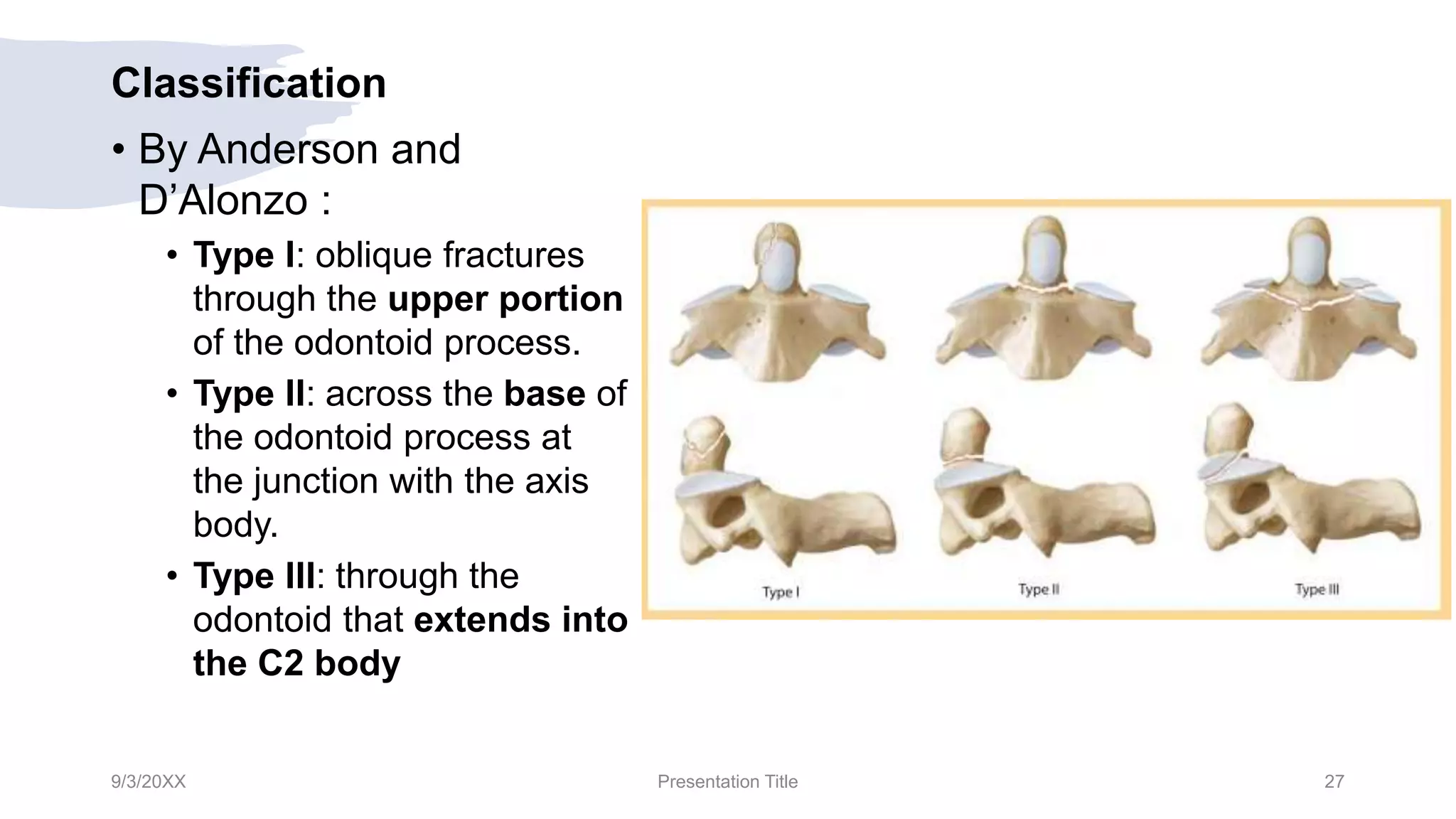 Cervical Spine Injury.pptx