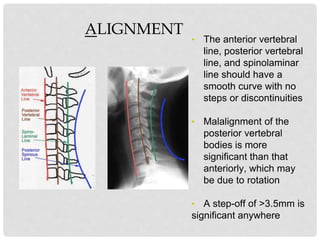 CERVICAL SPINE INJURY SURAIN edited.pptx