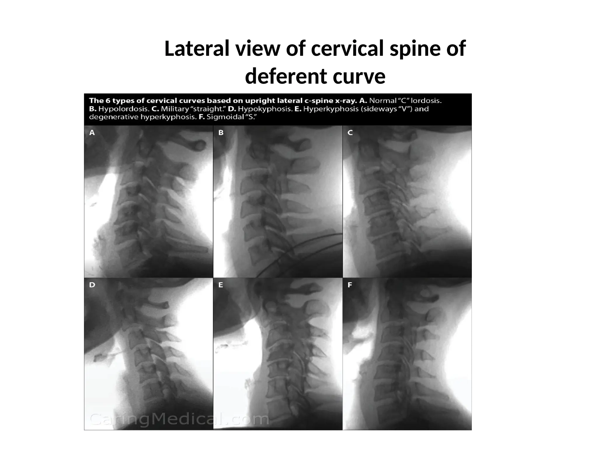 Cervical spine and architecture biomechanics | PPTX