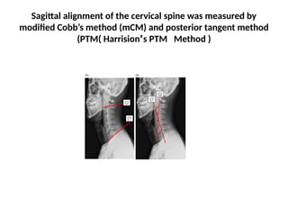Cervical spine and architecture biomechanics | PPTX